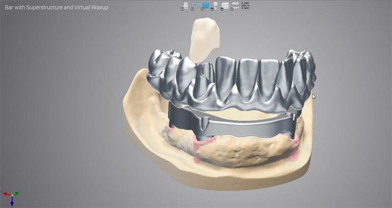 Downloads EN - Dental Wings