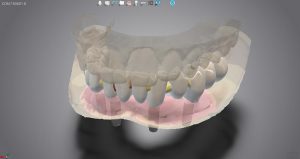 Downloads EN - Dental Wings